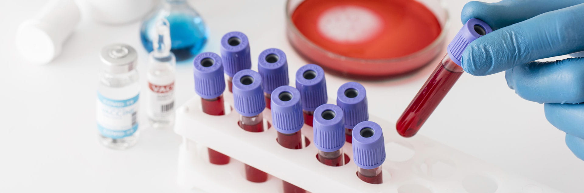 دستورالعمل‌های نمونه گیری برای مراجعین – آزمایشگاه انصار